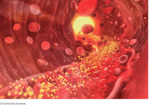 Redefining Cholesterol - Dr. Bob's Healthcare Blog